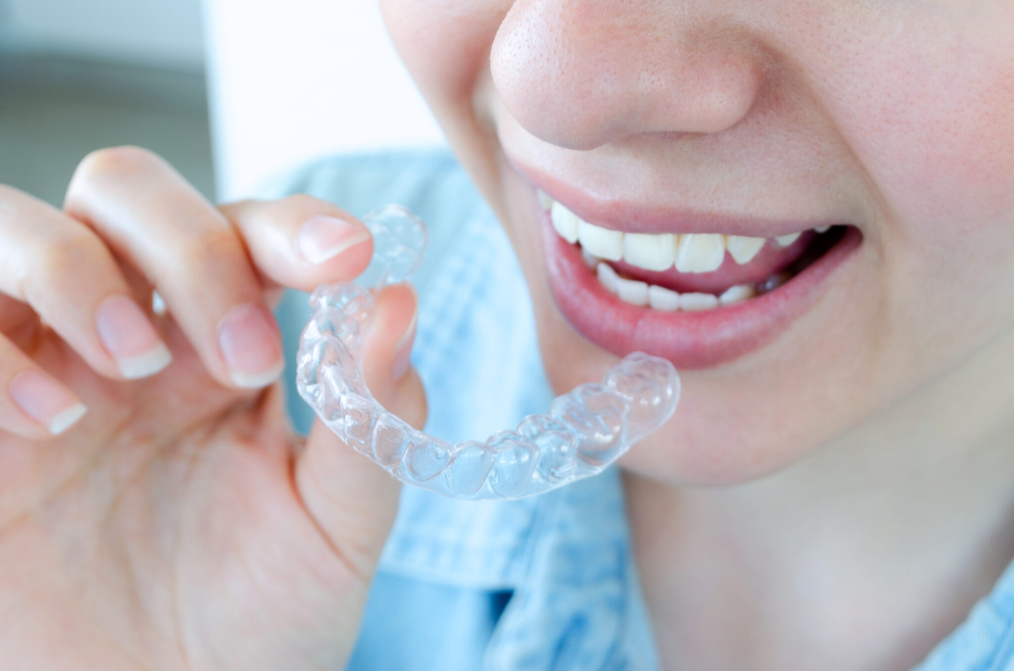 Correcting Smiles With Clear Aligners | Prairie Village, KS